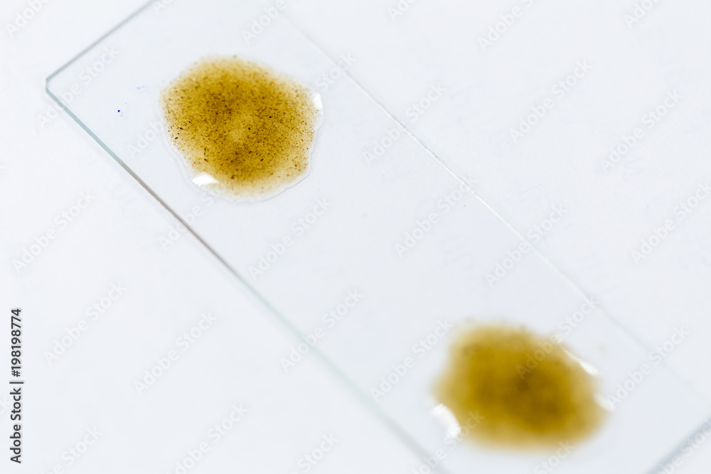 Finding parasites in feces in laboratory. Stock Photo | Adobe Stock