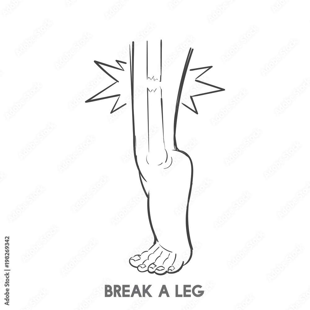 Break A Leg
