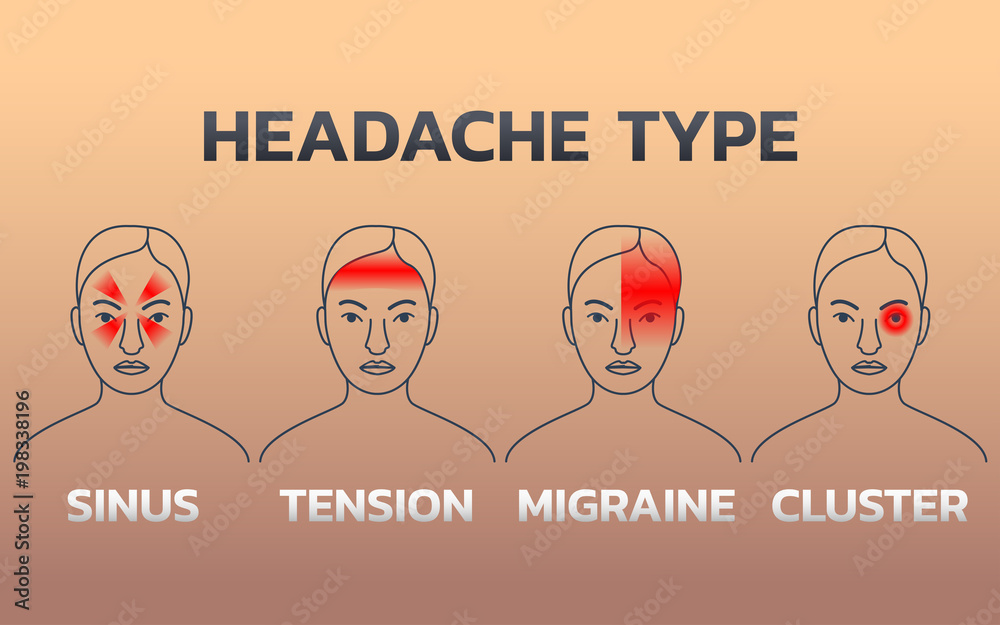 Types of Headaches Infographics design template, icon vector ...