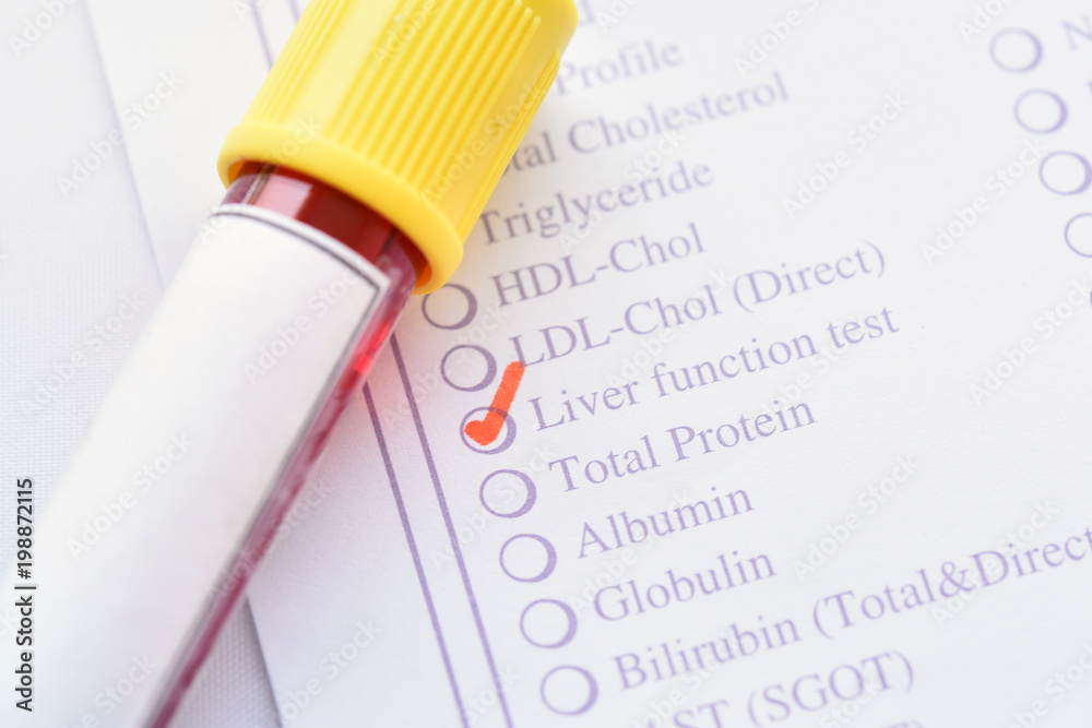 Blood sample for liver function test Stock Photo | Adobe Stock