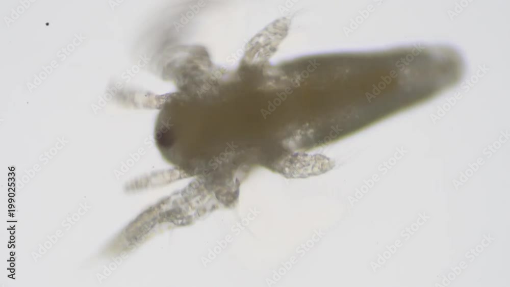 Baby of brine shrimp under microscope. The microscopic world. Stock ...