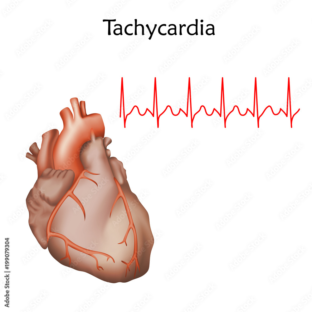 Human heart. Tachycardia. Anatomy illustration. Red image, white ...