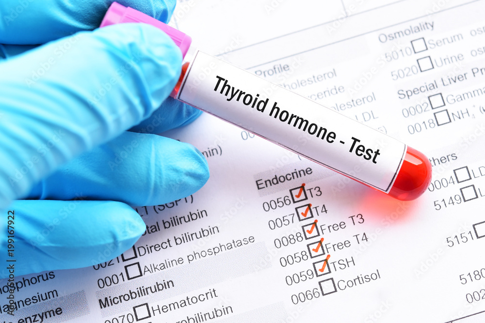 Blood sample for thyroid hormone test Stock Photo | Adobe Stock