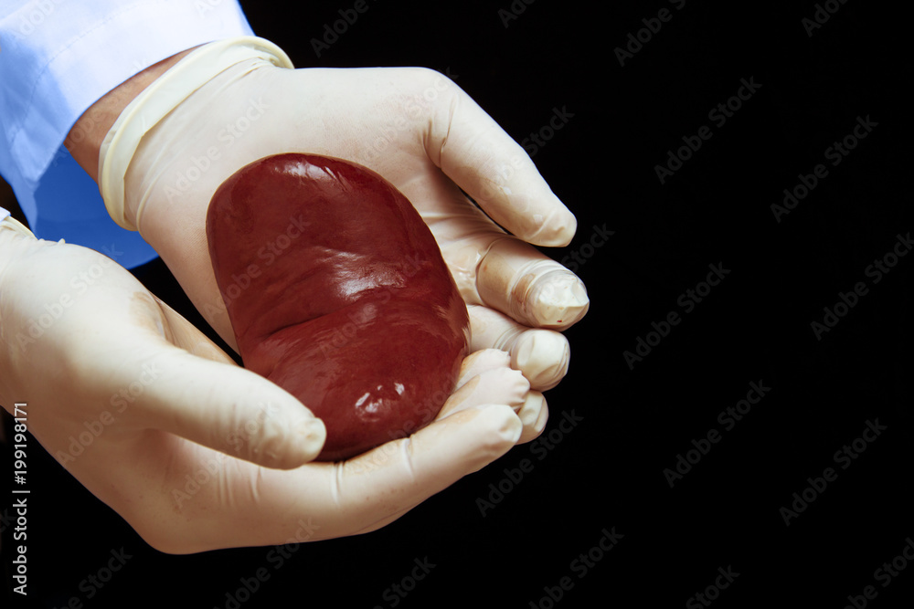 kidney transplant surgery concept. real kidney is in hands of ...