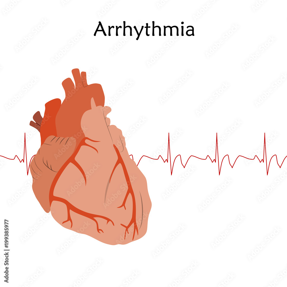 Human heart. Arrhythmia. Anatomy flat illustration. Red image, white ...