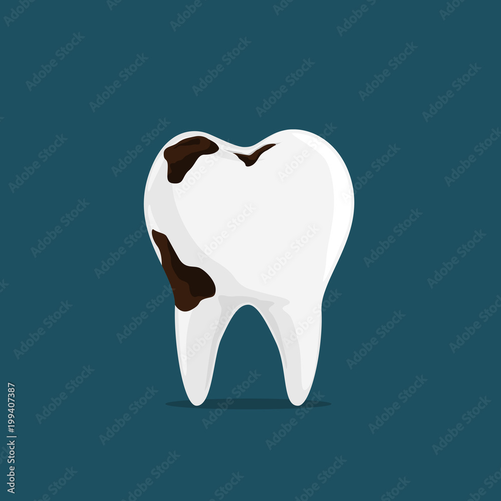 Caries Dental Problems, Big Hole in the Human Teeth iSolated on Dark ...