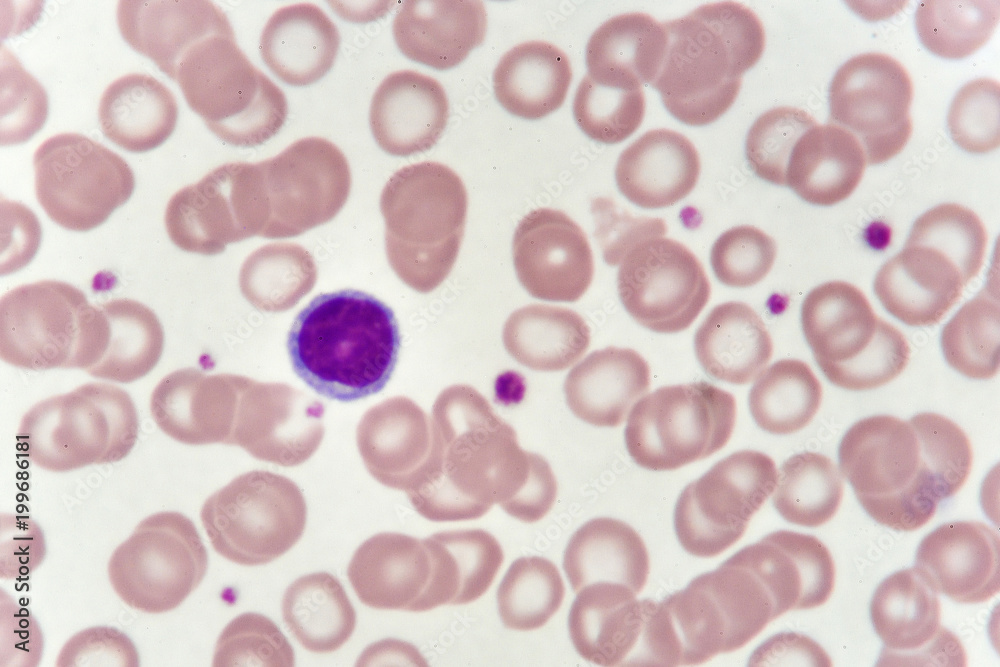 Lymphocytes Under Microscope