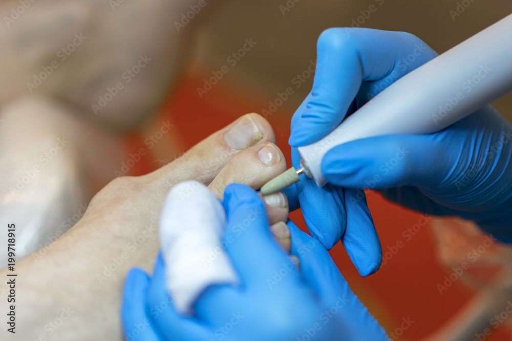 Professional hardware pedicure using electric machine.Patient on ...