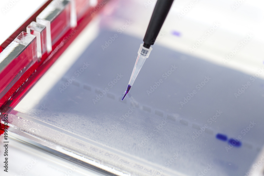 Agarose gel electrophoresis is a method of gel electrophoresis used in ...