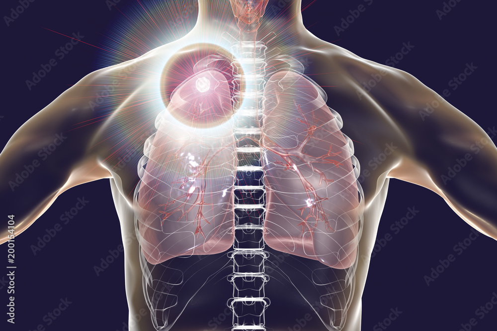 Tuberculosis treatment and prevention concept, 3D illustration showing ...
