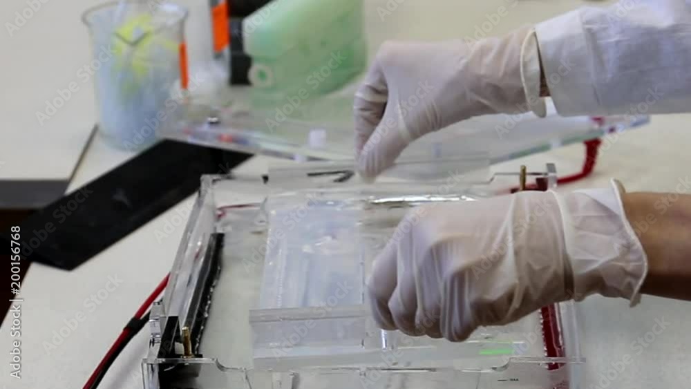 Scientist is taking agarose gel with samples for the separation of DNA ...