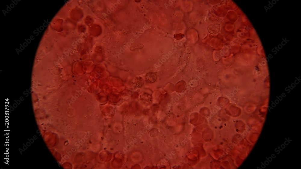 Video Stock menstrual blood with its microflora and bacteria under ...