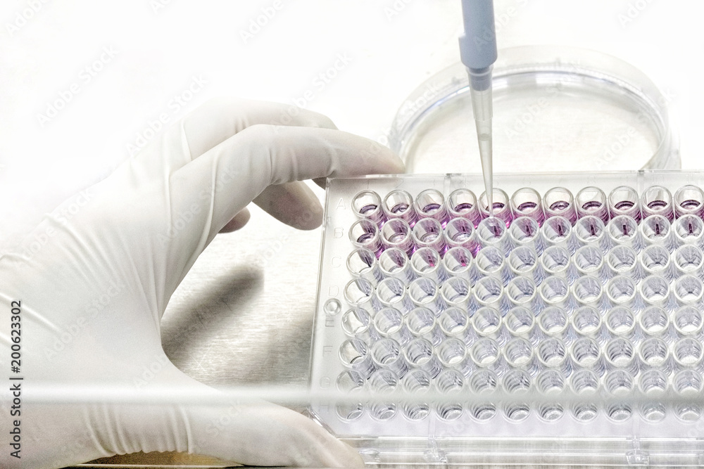 The researcher is using pipette to transfer liquid from petri dish to ...