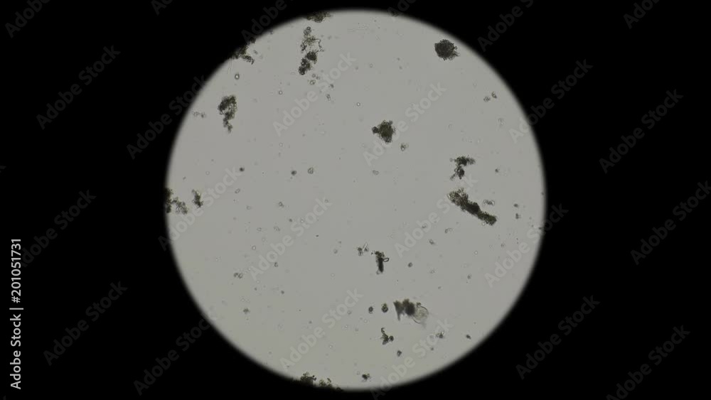 Vidéo Stock microorganisms, inhabitants of reservoirs under a ...