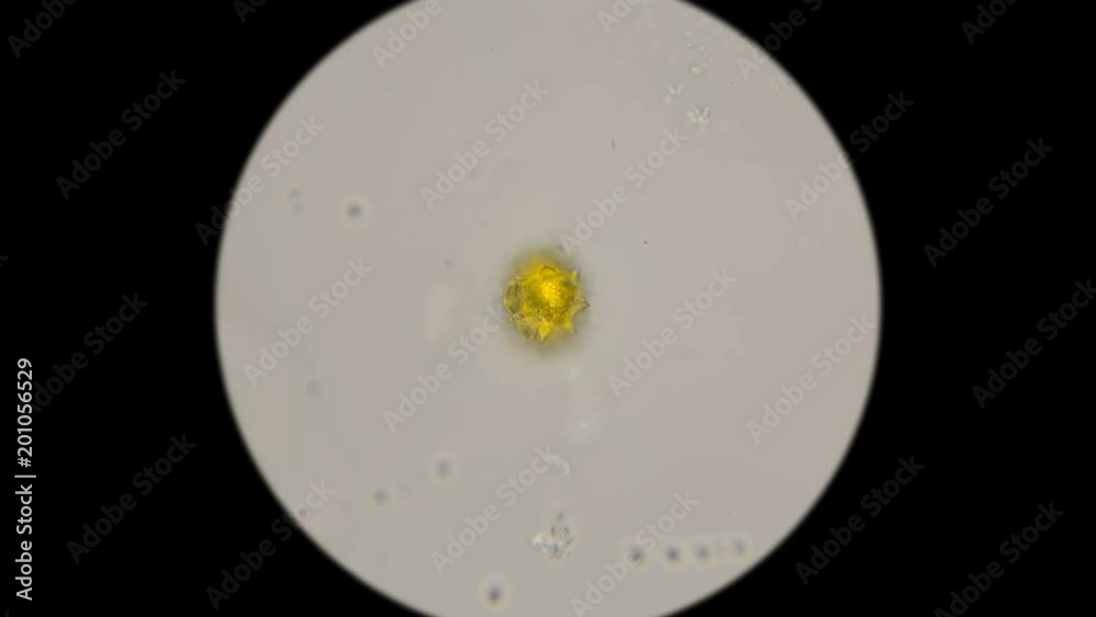 rotavirus infection in human saliva under a microscope Stock Video ...