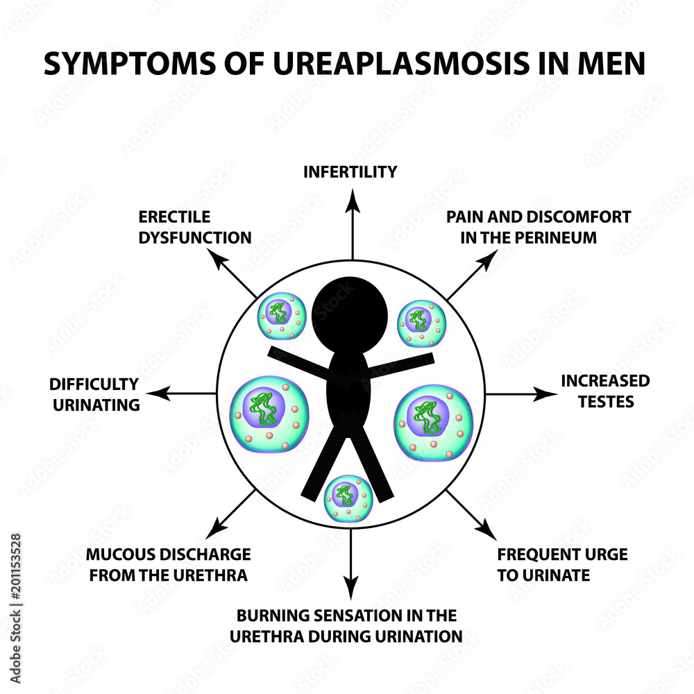 Symptoms of ureaplasmosis in men. The structure of ureaplasma ...