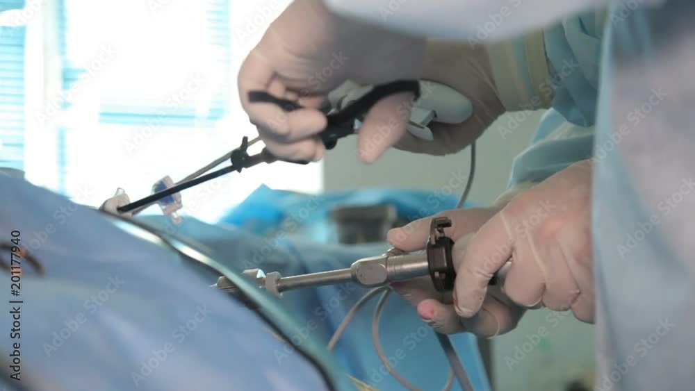 Removal of malignant tumor in the kidney. Resection of the kidney ...