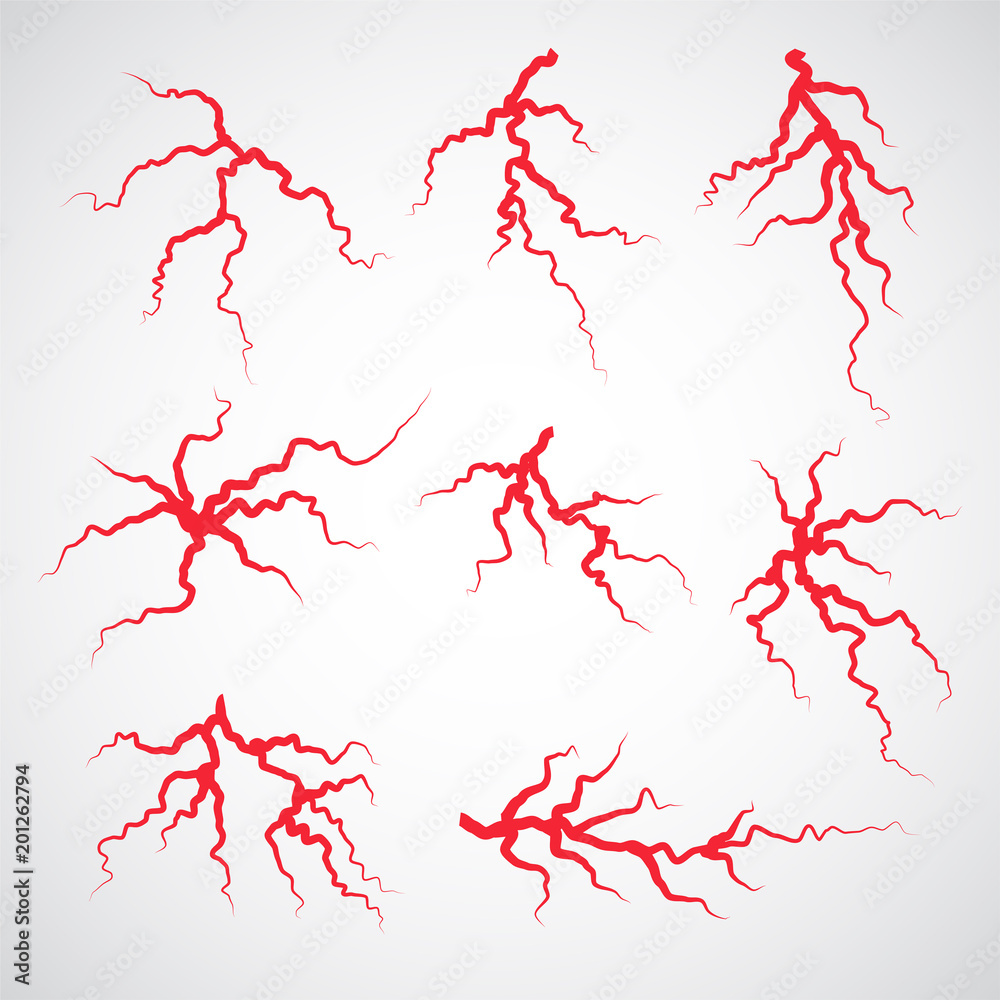 Capillary blood system set, which can be seen under skin surface when ...