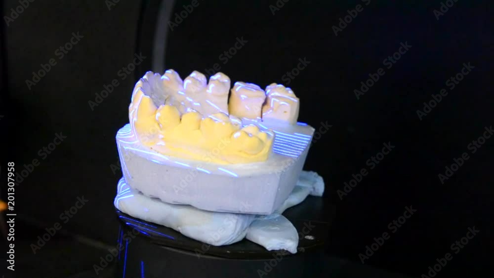 3D Scanning a model of human teeth from gypsum close-up. Creation 3D ...
