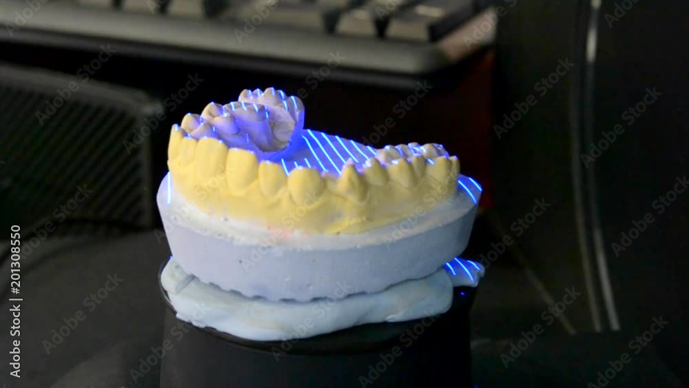 3D Scanning a model of human teeth from gypsum close-up. Creation 3D ...