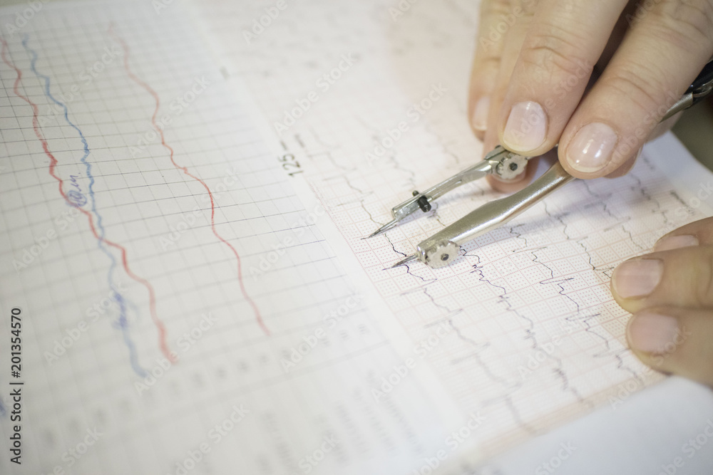 doctor's hands checking for a pulse on the ECG paper about heart ...