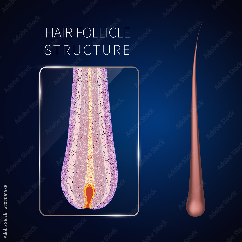 Hair bulb under the microscope. Follicle structure closeup. Removal ...