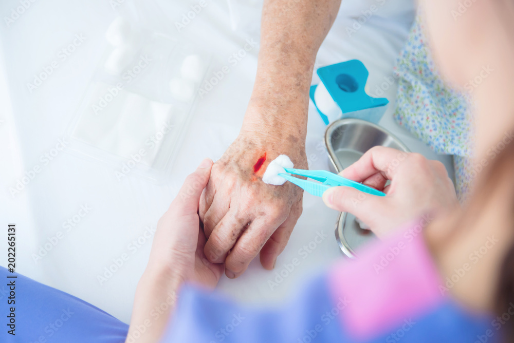 Closeup of nurse's hands dressing wound for patient's hand with injury ...