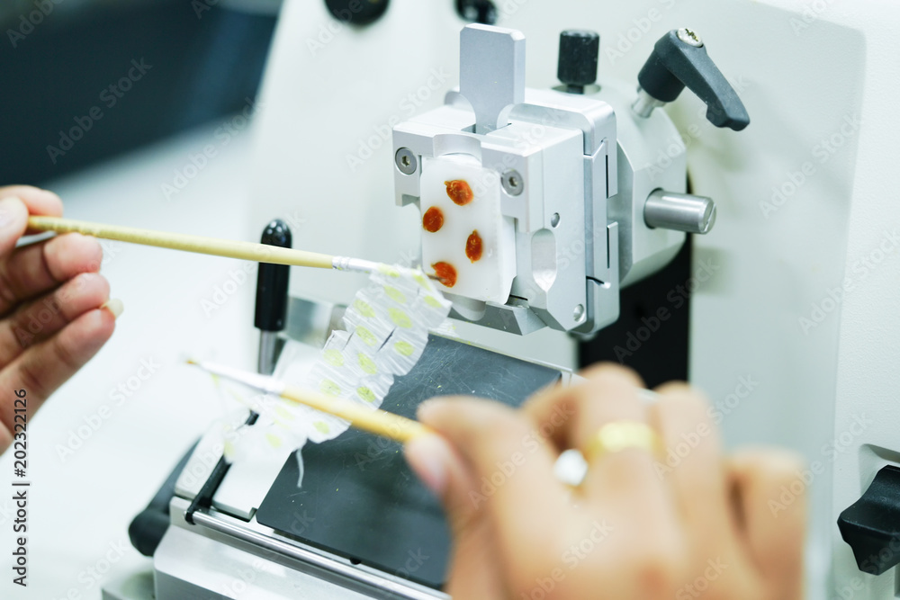 Rotary Microtome Section for diagnosis in pathology make microscope ...