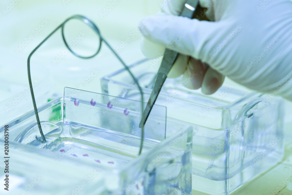 Microscope slide staining tissue biopsy for diagnosis in pathology ...