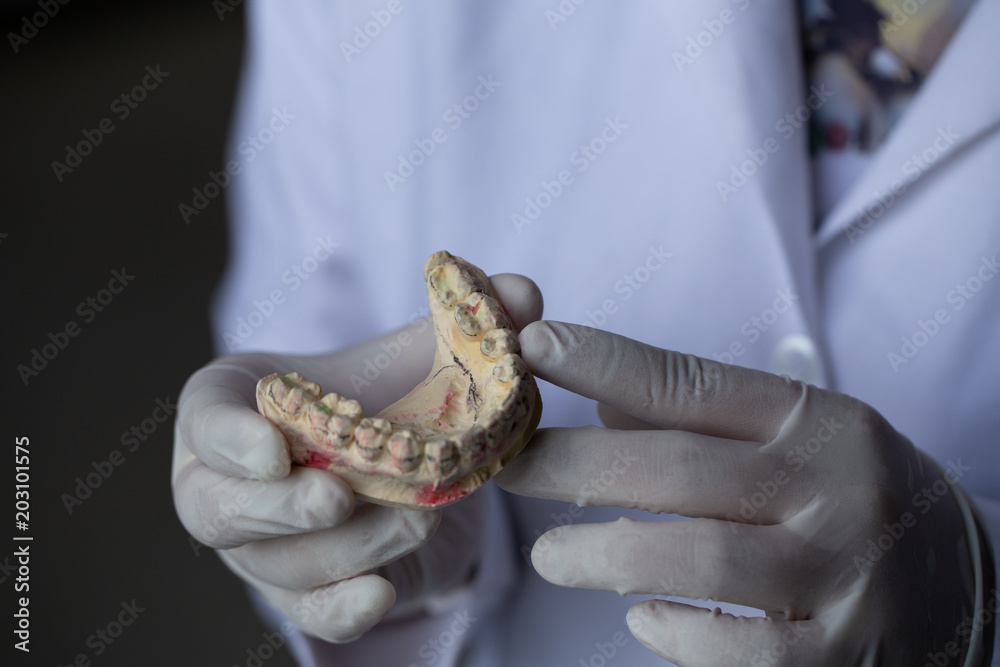 Study cast of Diagnostic cast and dental gypsum models in dental ...