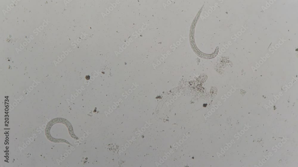 Video „parasite : Strongyloides stercoralis from human feces under ...