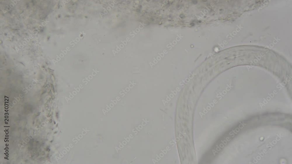 parasite : Strongyloides stercoralis from human feces under microscope ...