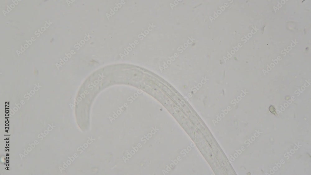 parasite : Strongyloides stercoralis from human feces under microscope ...