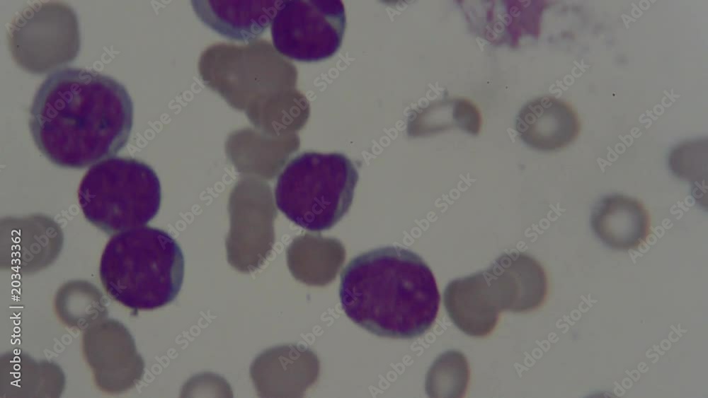 human blood smear under microscope , for analysis in laboratory vídeo ...