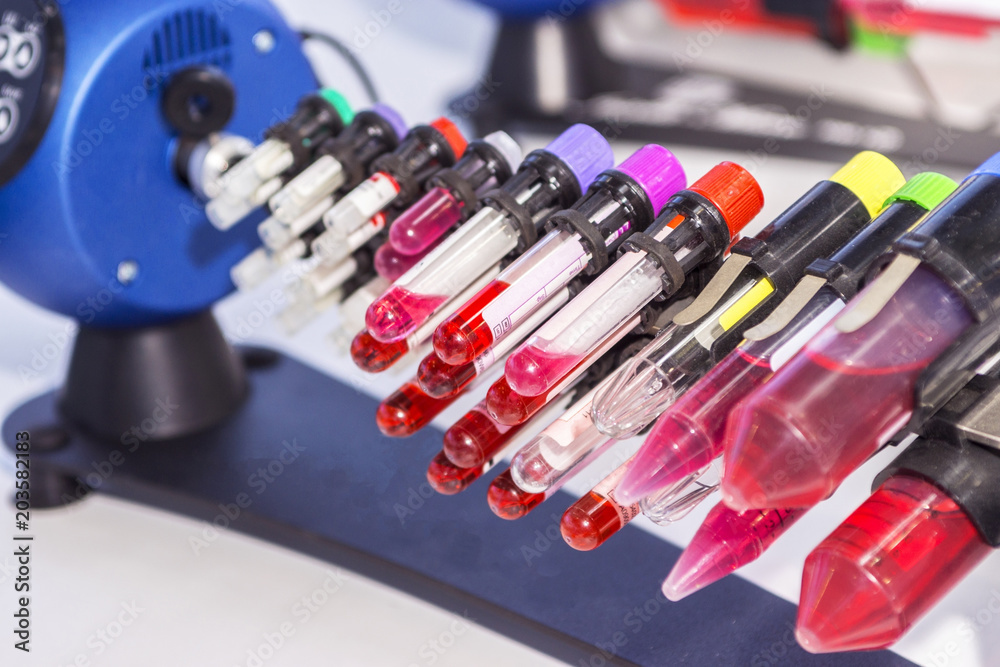 Apparatus for blood fractionation and analysis Stock Photo | Adobe Stock