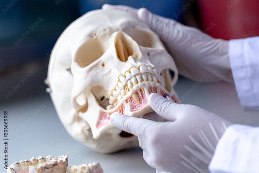 Study cast of Diagnostic cast and dental gypsum models in dental ...
