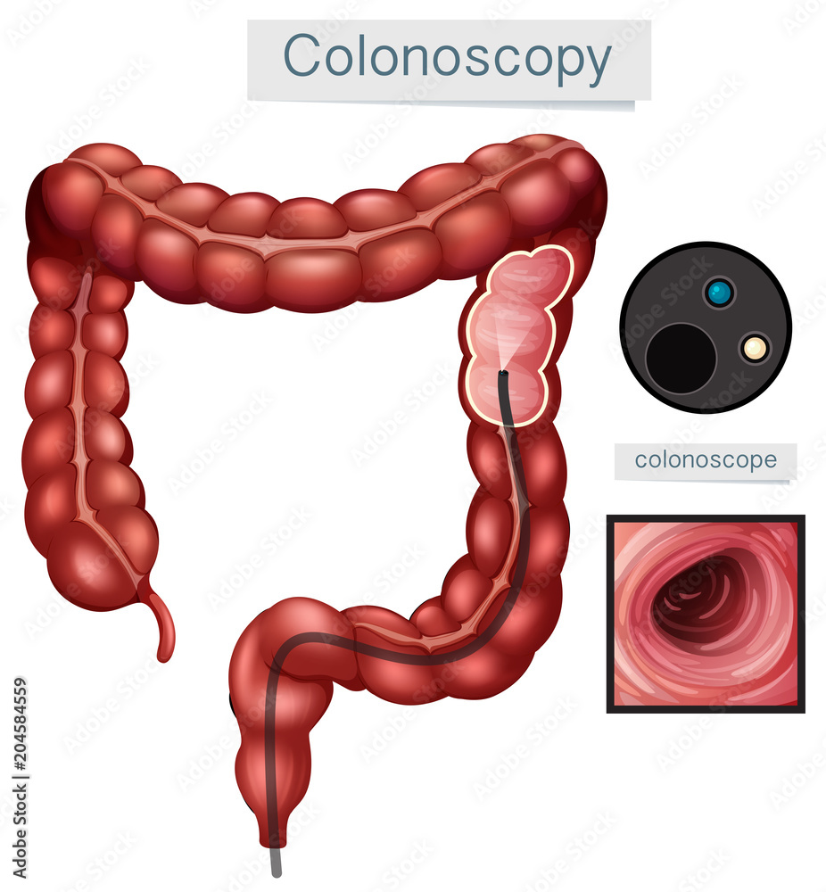 Human Anatomy Colonoscopy on White Background Stock Vector | Adobe Stock