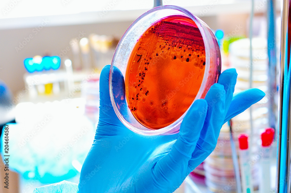 Petri dish. Microbiological laboratory. Mold and fungal cultures ...