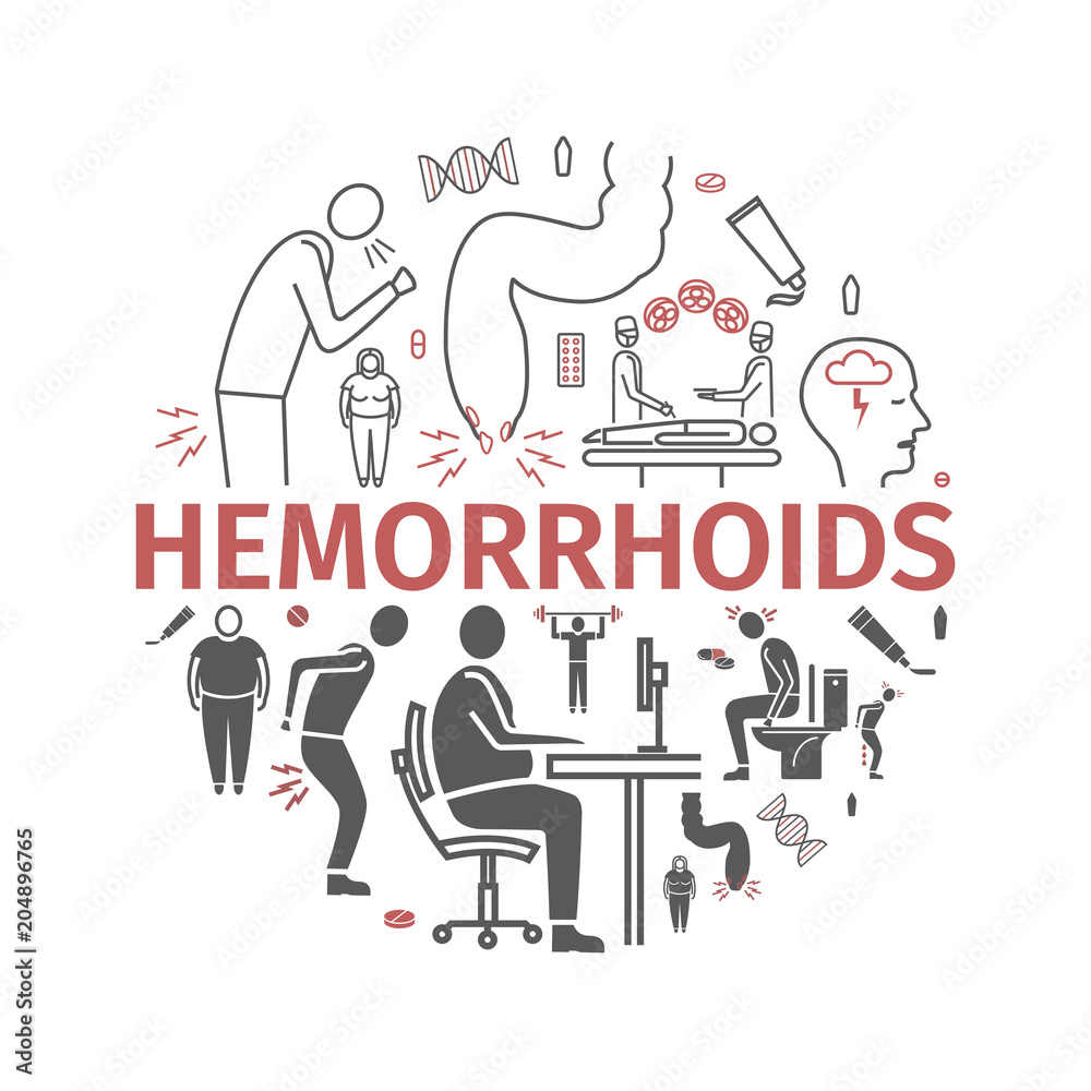 Hemorrhoids banner, icon Infographics. Vector signs for web graphics. Stock Vector | Adobe Stock