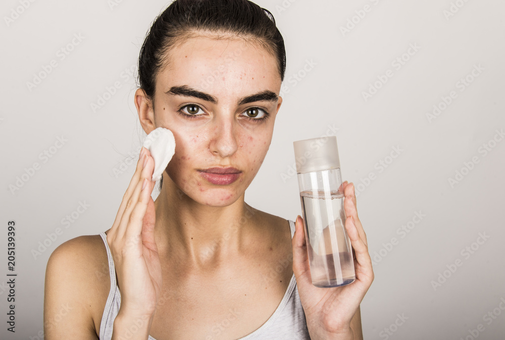 beautiful young girl with problematic skin, acne face and cleaning ...