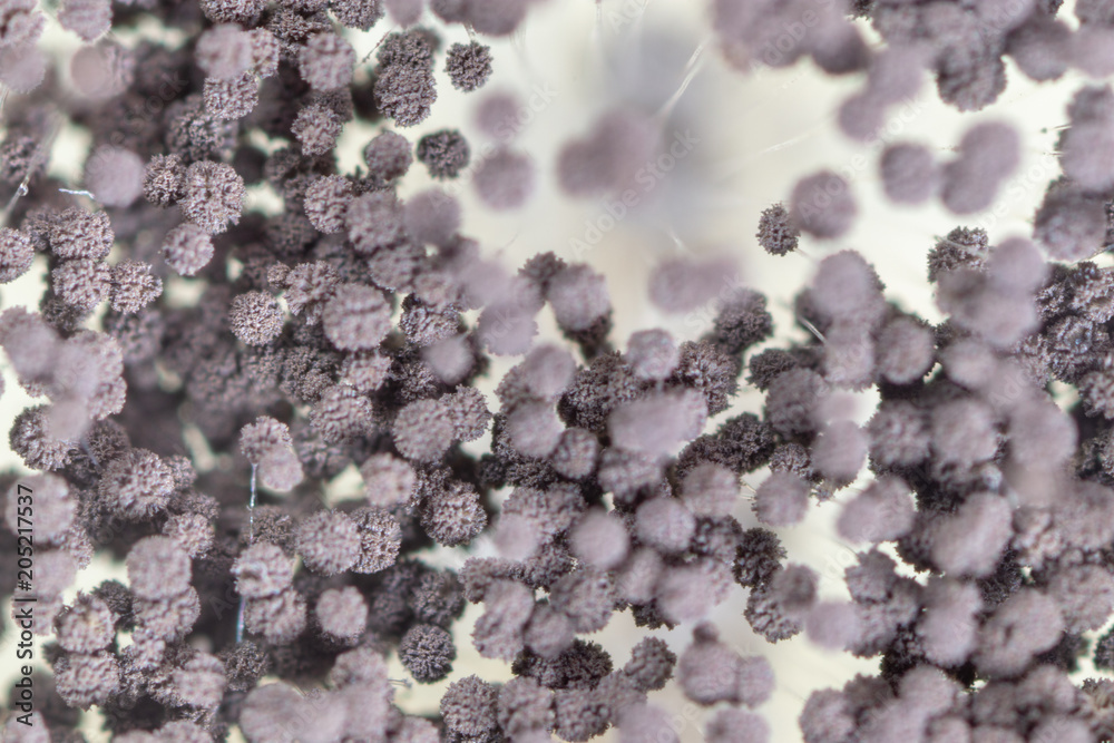 Rhizopus (bread mold) is a genus of common saprophytic fungi,Rhizopus ...