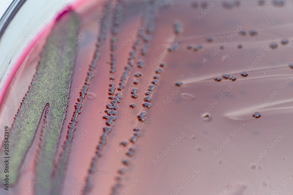 Escherichia Coli Colony Morphology