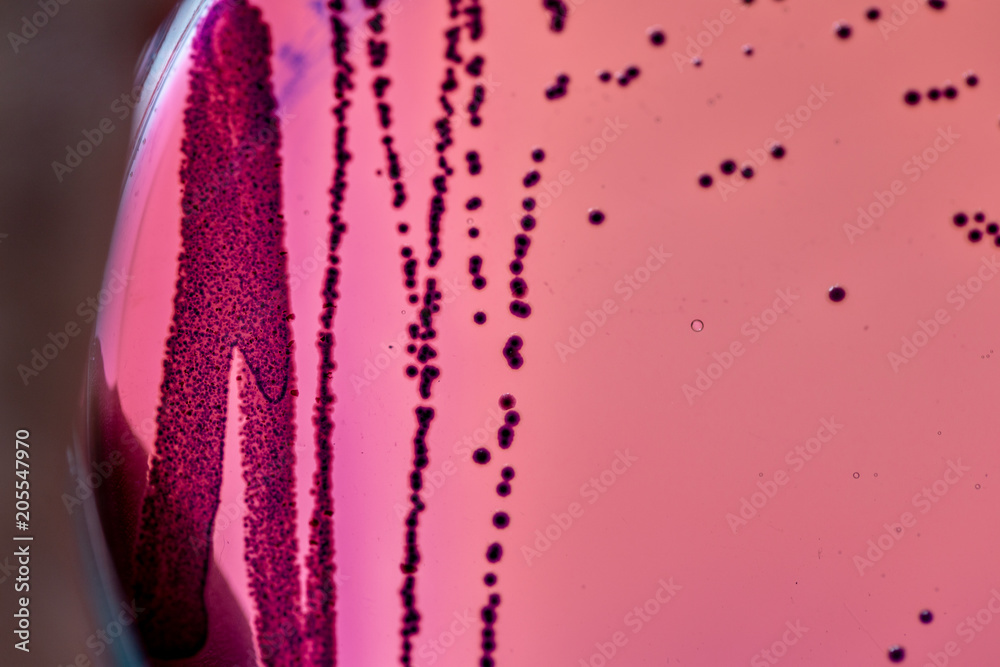 Colony Characteristics of Escherichia coli (E. coli) is a Gram-negative ...