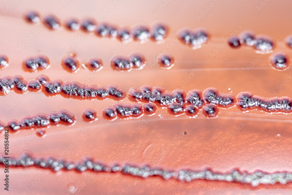 Escherichia Coli Colony Morphology