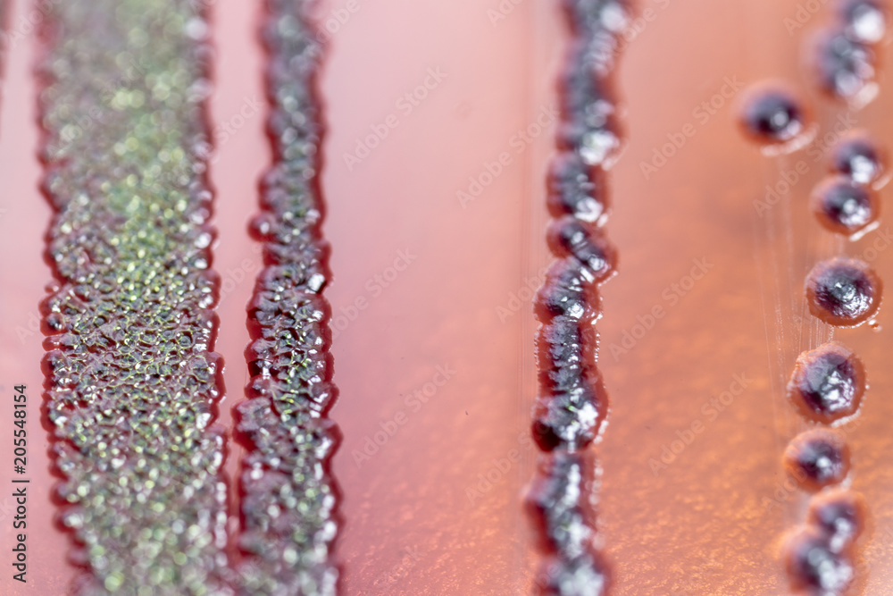 Colony Characteristics of Escherichia coli (E. coli) is a Gram-negative ...