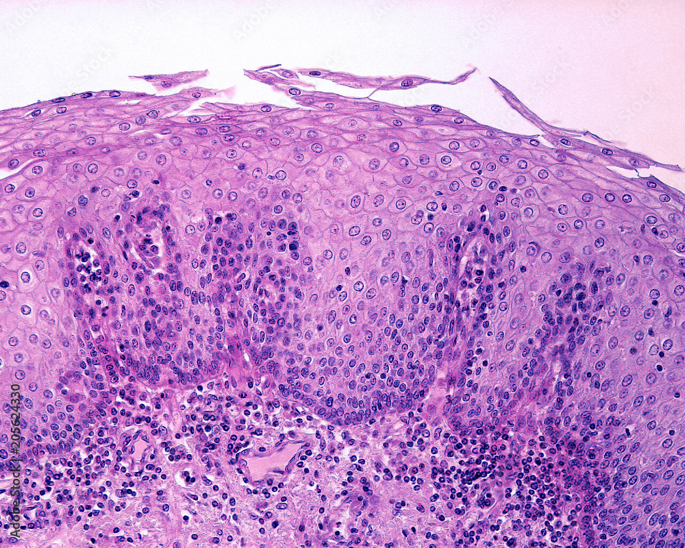 Epithelium of esophagus Stock Photo | Adobe Stock