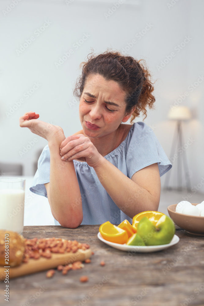 Sudden rash. Adolescent woman sitting at a dinner table looking worried ...