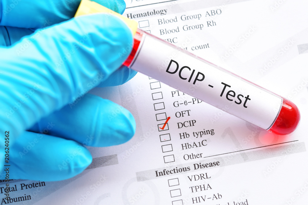 Laboratory requisition form with blood sample tube for DCIP ...