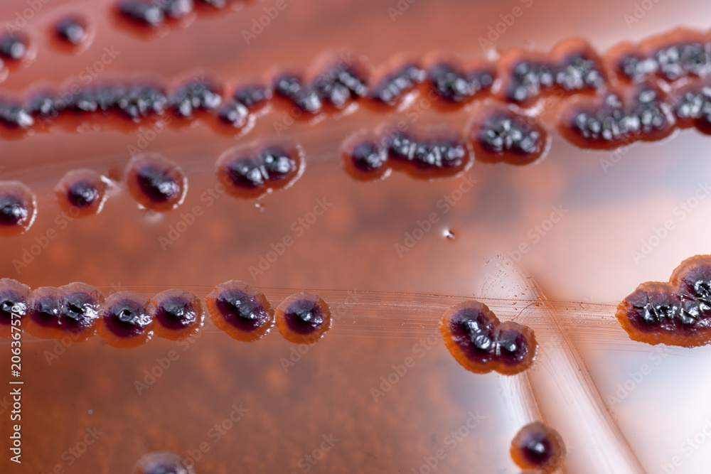 Colony Characteristics of Escherichia coli (E. coli) is a Gram-negative ...