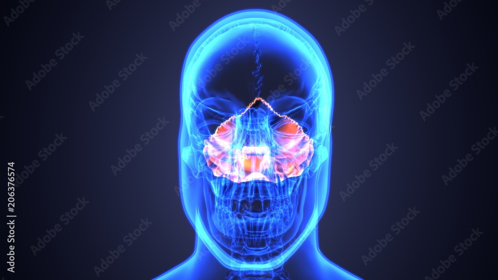 3d illustration of Sinusitis . of human skull with inflamed at sinus ...